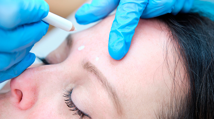 Toxina Botulínica | OA Clinic Dermatologia